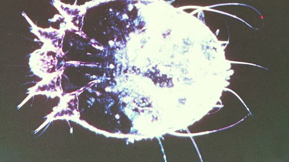 Utbrott av skabb på förskola och skola – flera fall har bekräftats ...