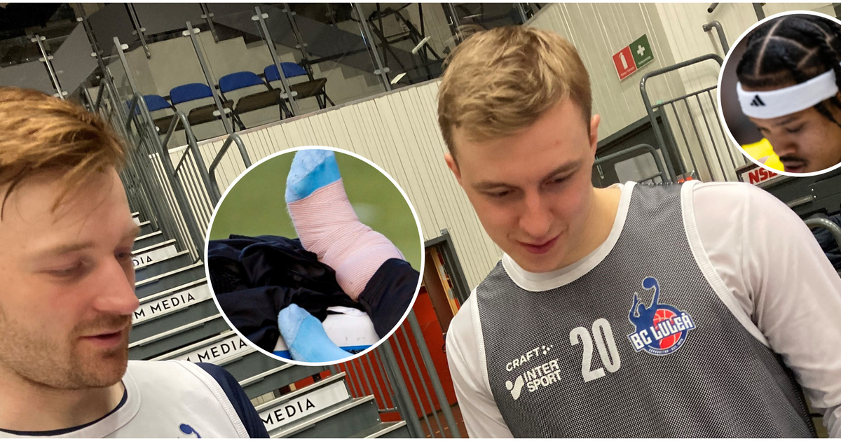Isade fel fot efter stukning • Han härmar stjärnornas frisyrer
