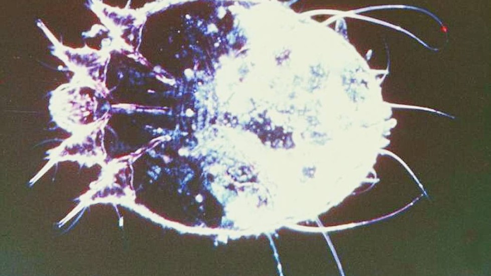 Utbrott av skabb på äldreboende – personal och gamla drabbade